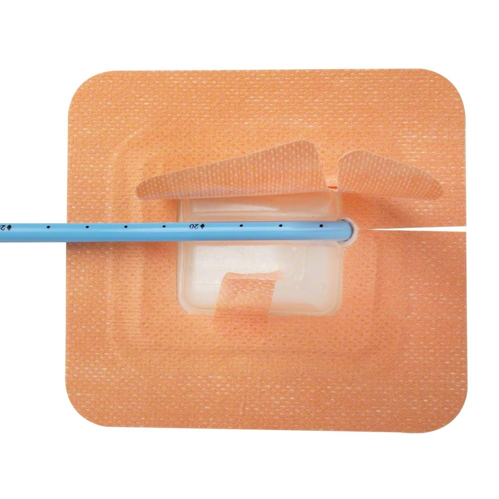 ACCEL® All-purpose and Biliary Drainage Catheter Sets